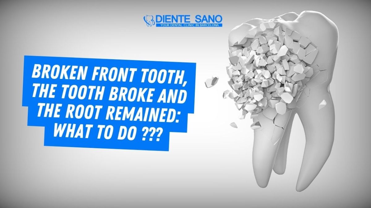 Broken front tooth, a tooth has broken and the root remains: what to do ...